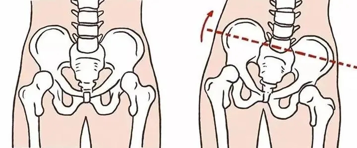 Hip exercises ~ Academie de Bernadac : Academie de Bernadac